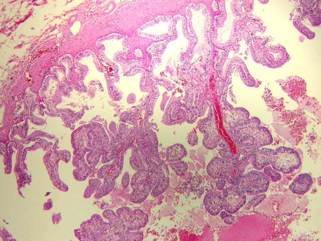 microscopic gallbladder